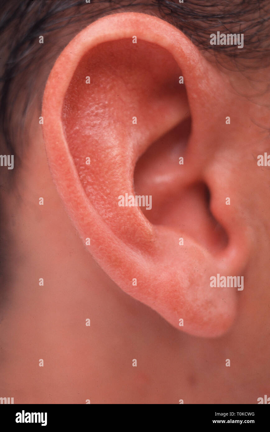 Males ear hi-res stock photography and images - Alamy