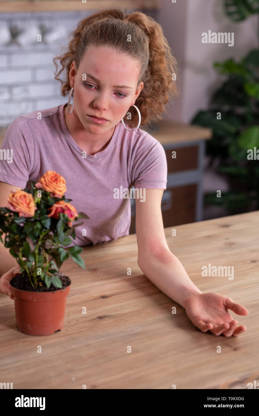 Annoyed light-haired girl having extreme allergic reaction Stock Photo ...