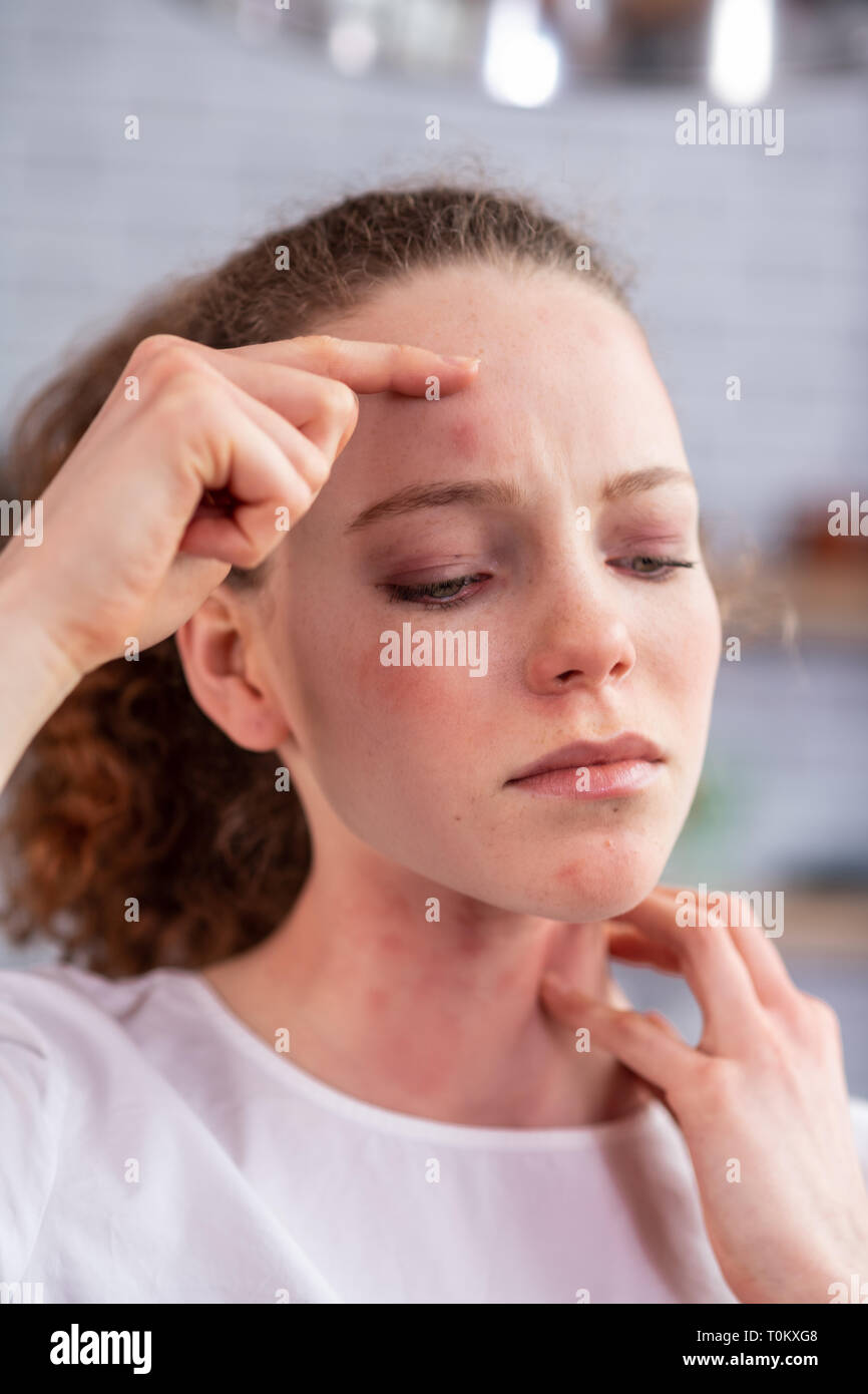 Miserable long-haired lady having problems with skin Stock Photo - Alamy