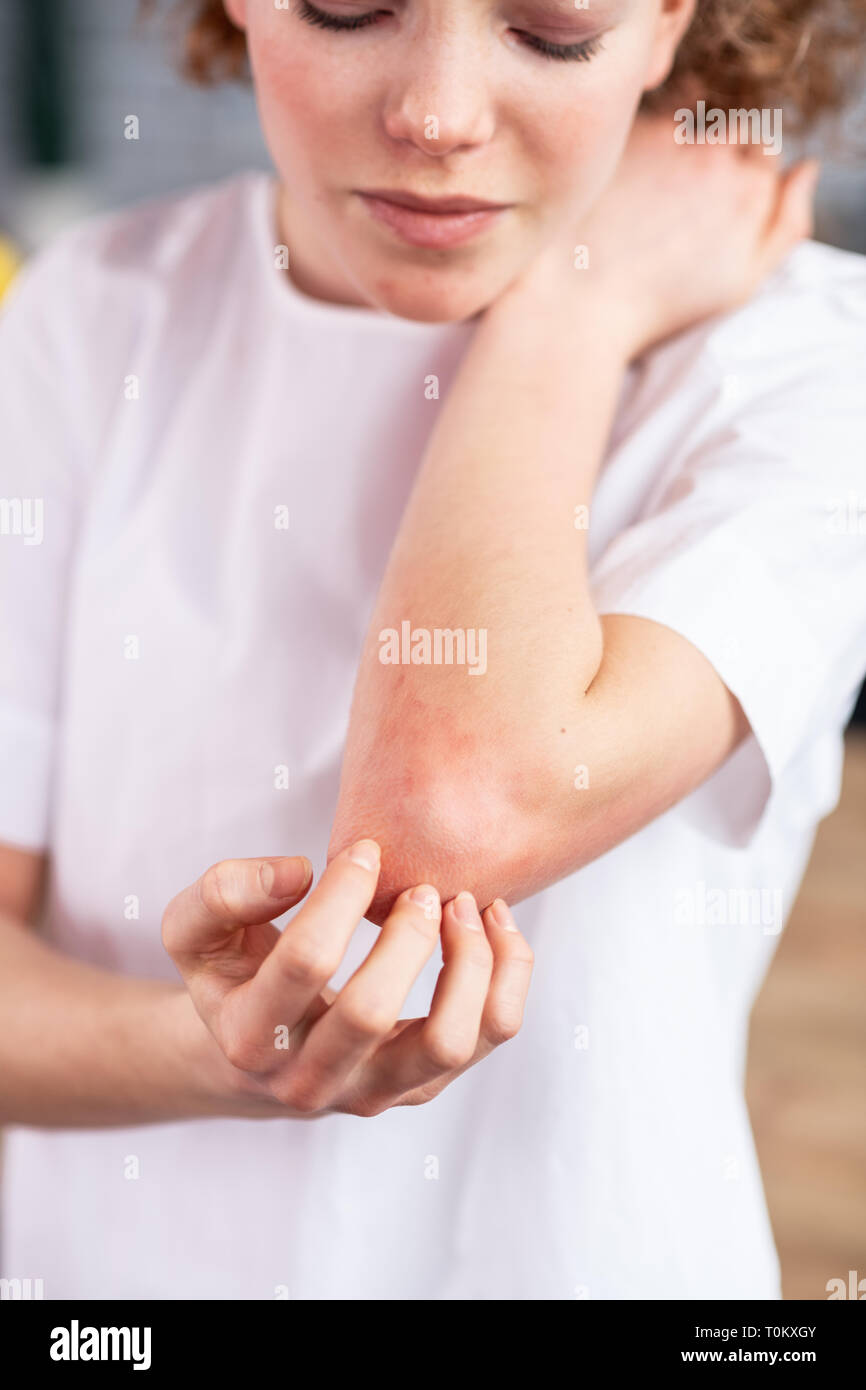 Red rash shirt hi-res stock photography and images - Alamy