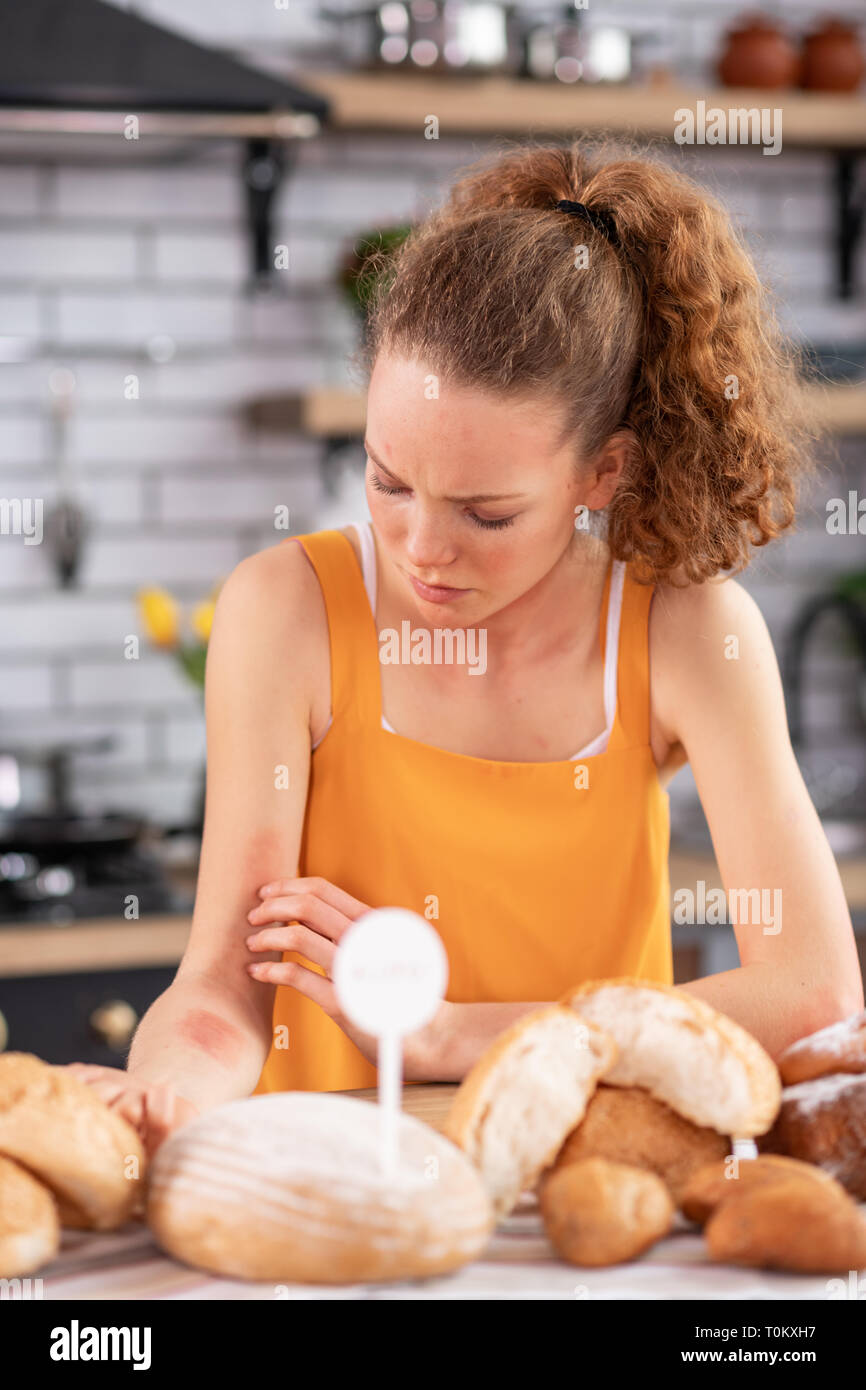 Miserable ginger girl in yellow apron scratching her rash Stock Photo ...