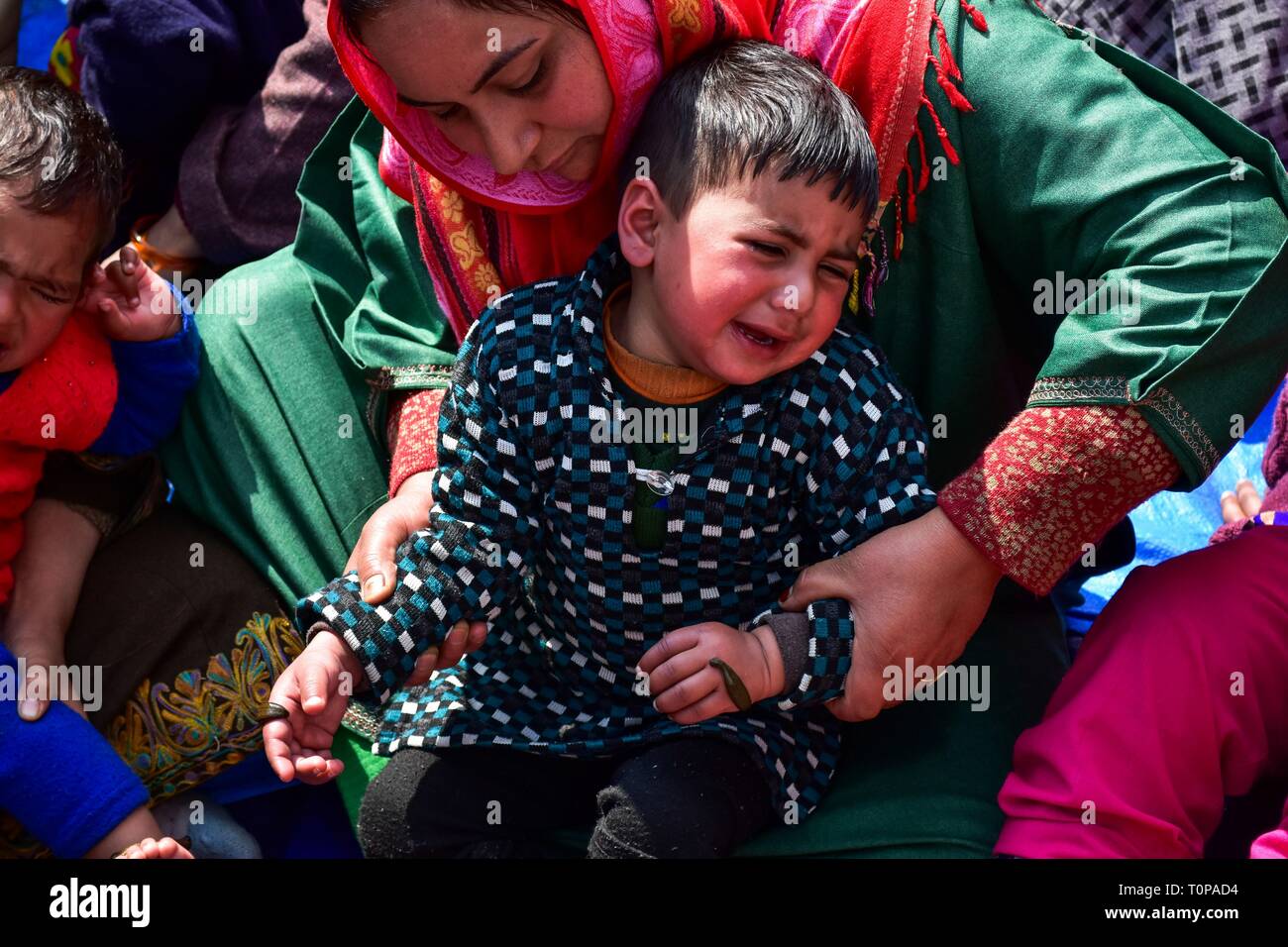 March 21, 2019 - Srinagar, J&K, India - A young patient seen with ...