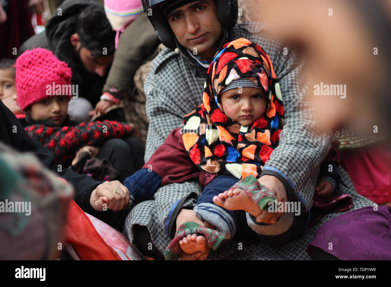 Srinagar, Kashmir. 21st Mar, 2019. A local Kashmiris receives leeches ...