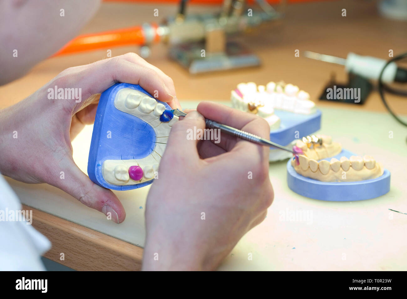 Dental Laboratory - teeth prosthetics Stock Photo - Alamy