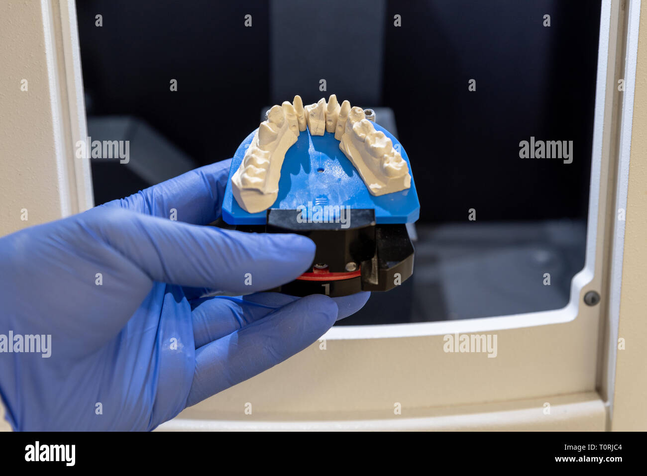 Specialized dental 3D scanner reads information from the plaster model ...