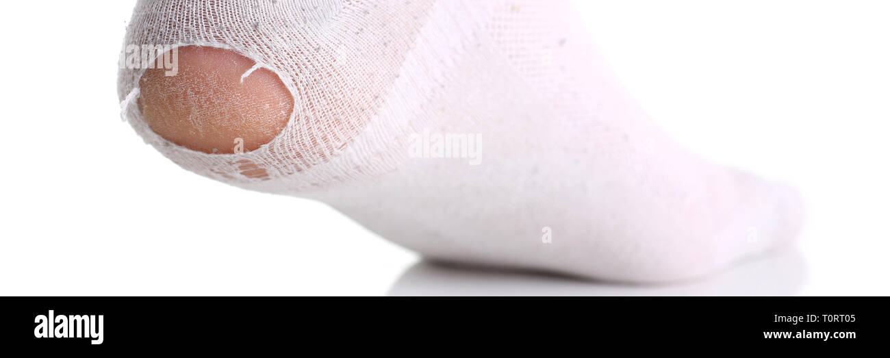 Ripped sock hi-res stock photography and images - Alamy