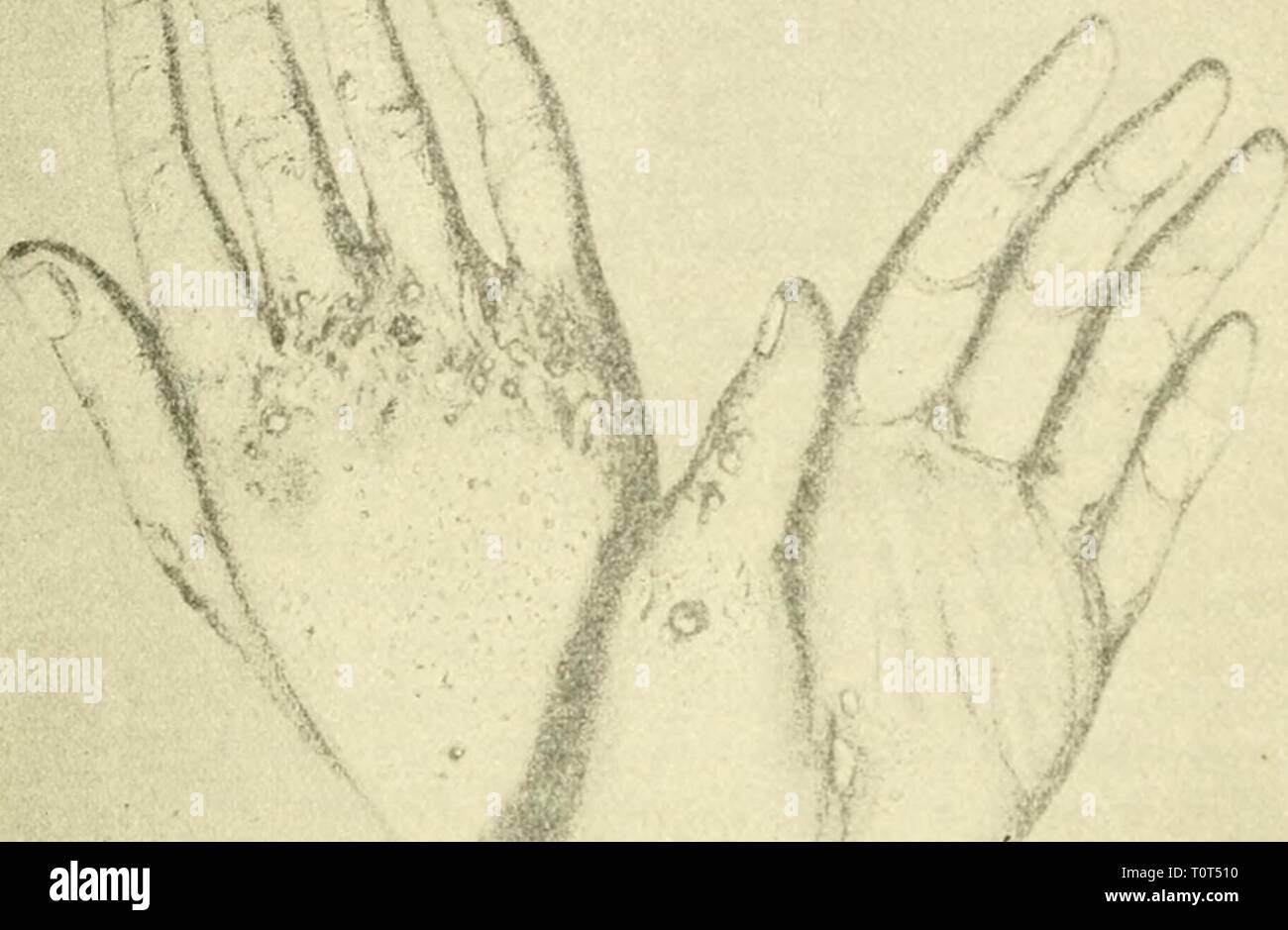 Dr Chase's third, last and Stock Photo - Alamy