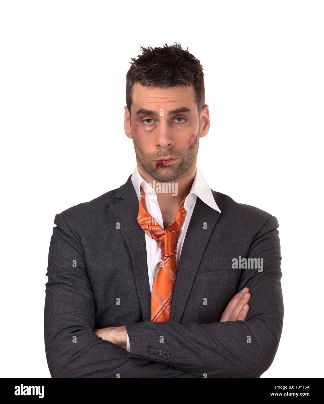 Man with bleeding lip hi-res stock photography and images - Alamy