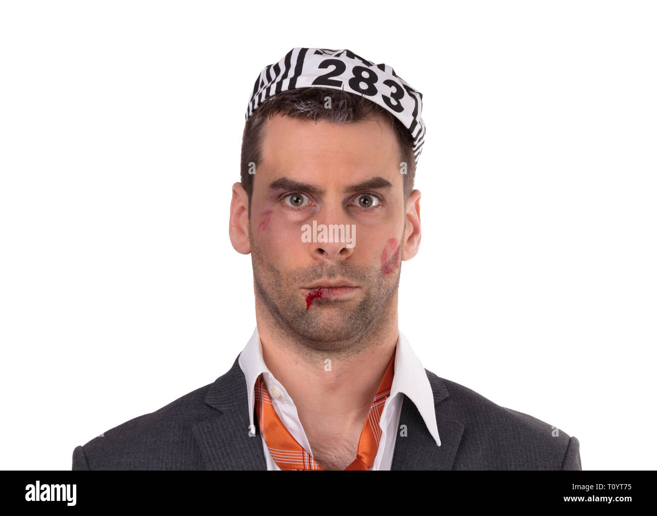 Man with bleeding lip hi-res stock photography and images - Alamy