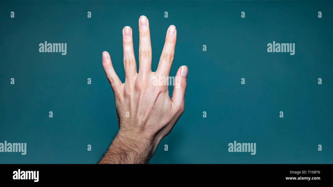 Ganglion cyst hi-res stock photography and images - Alamy