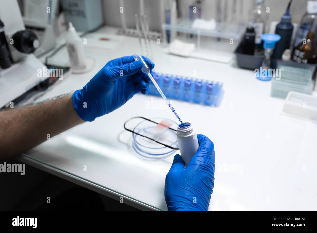 scientist prepare blood sample for research on microscope. Placing ...