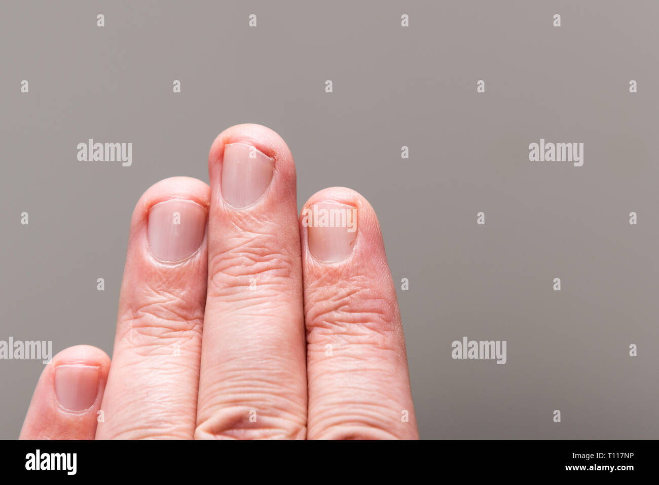 Normal crook hi-res stock photography and images - Alamy