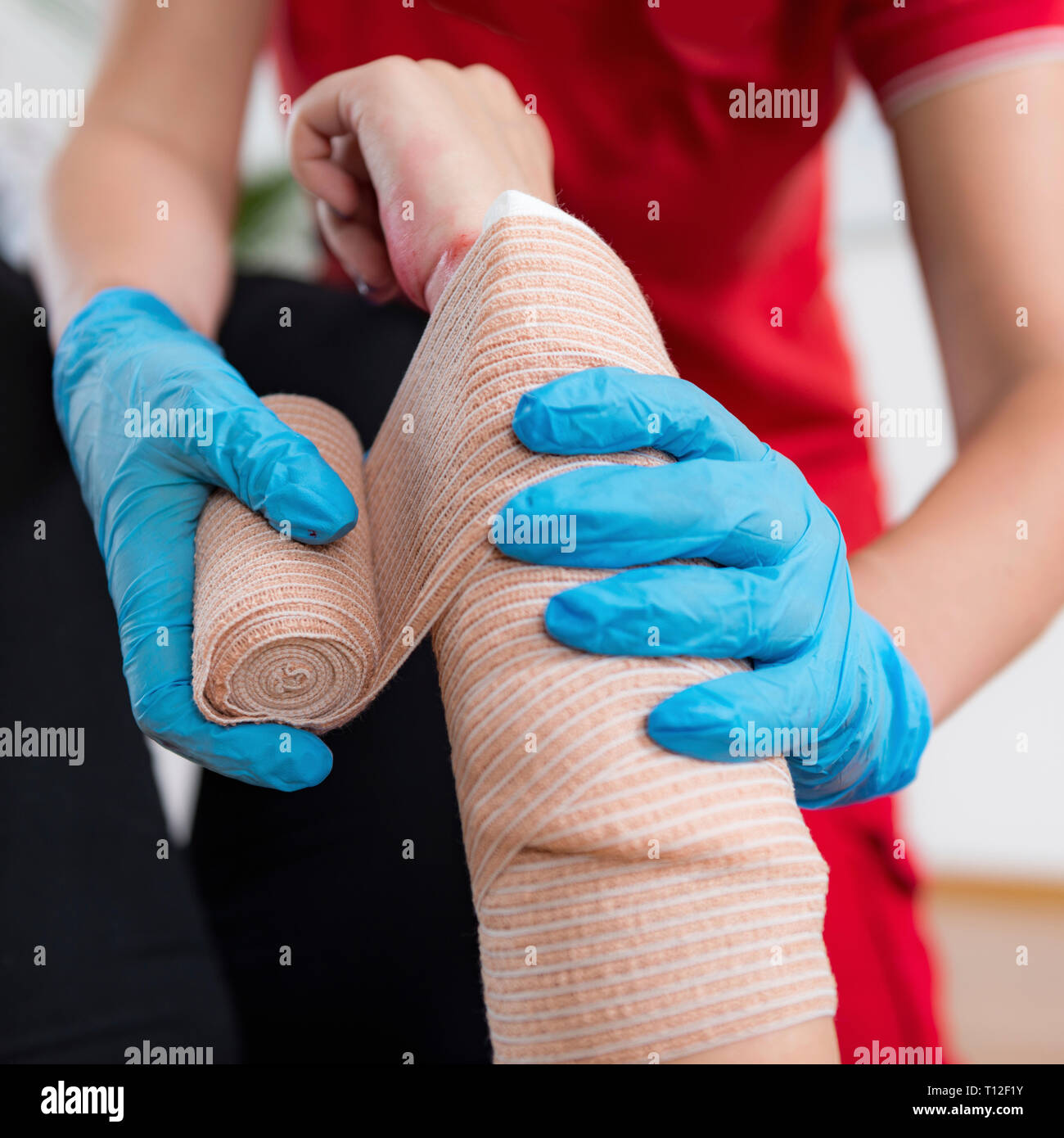 First aid training. Burn injury. First aid course Stock Photo - Alamy