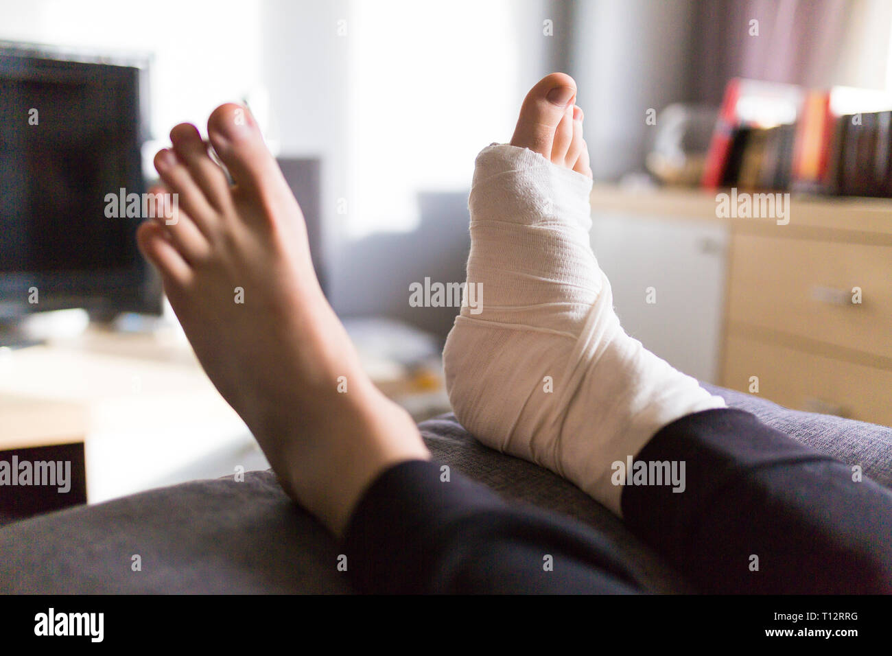 Man leg cast hi-res stock photography and images - Alamy