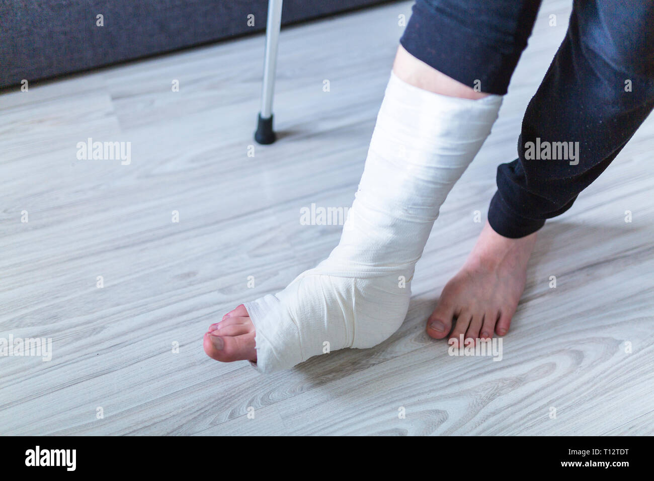 Plaster leg cast legs hi-res stock photography and images - Alamy
