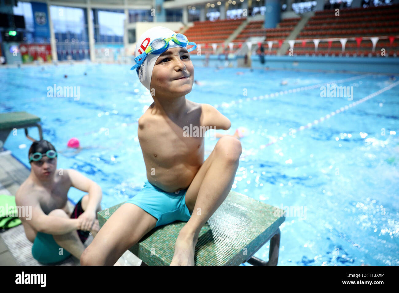 Deformed leg hi-res stock photography and images - Alamy