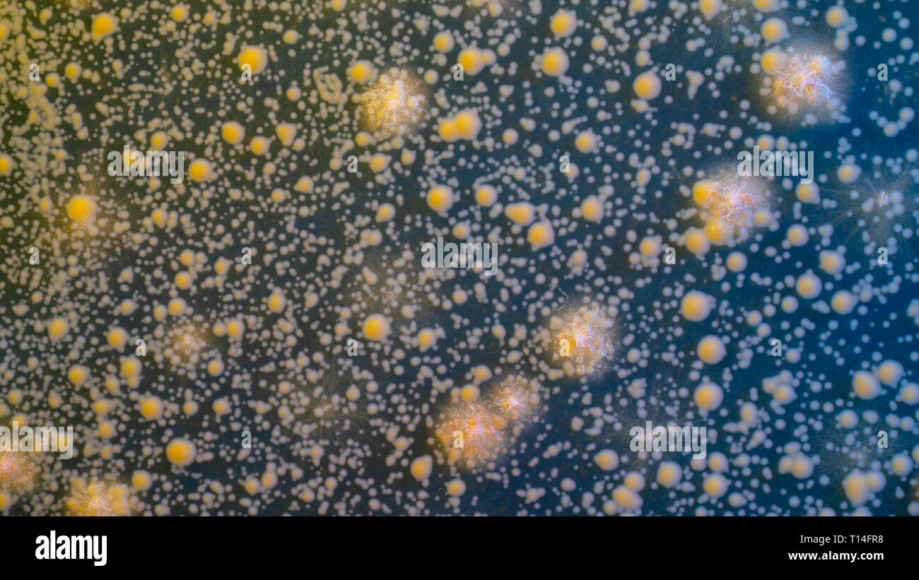 close up petri of dish with microbe colony Stock Photo - Alamy