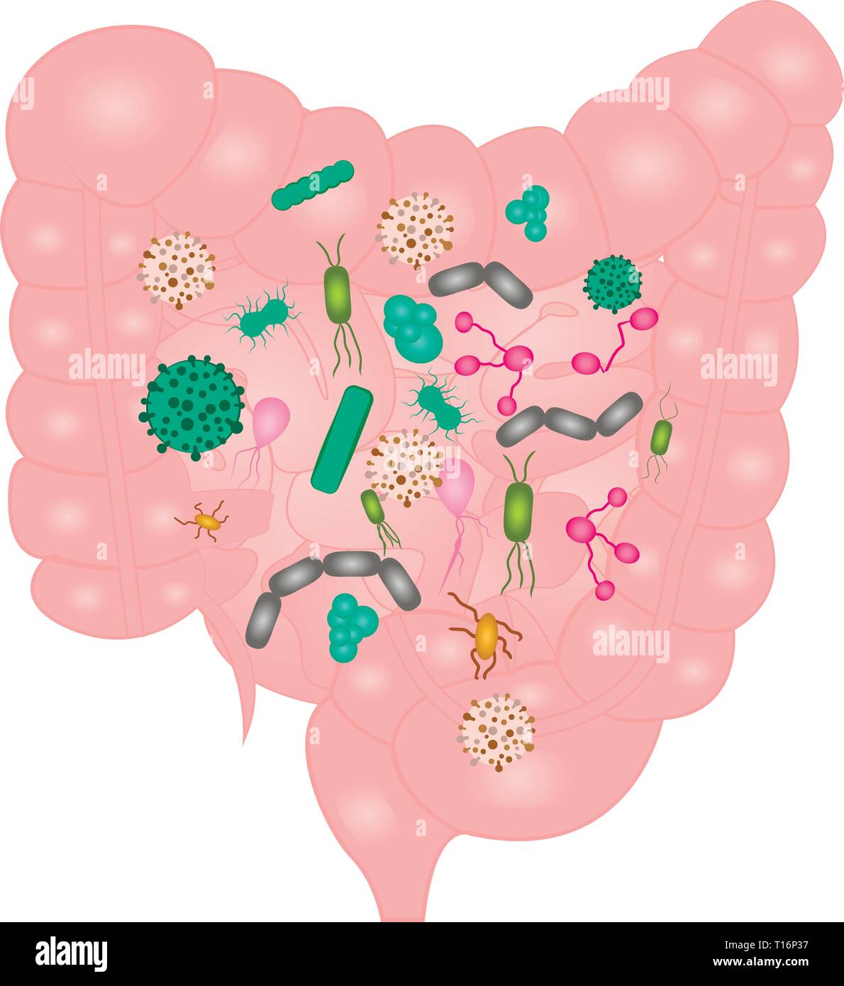 Bacterial Overgrowth Small Intestinal Bacterial Overgrowth (SIBO):