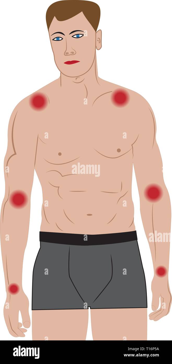 Joint pain in arms from infected or injury male body vector ... Joint pain in arms from infected or injury male body vector ...
