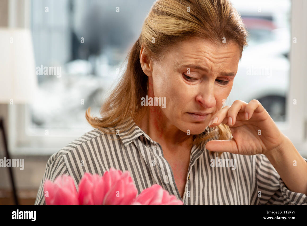 Allergic sensitivity hi-res stock photography and images - Alamy