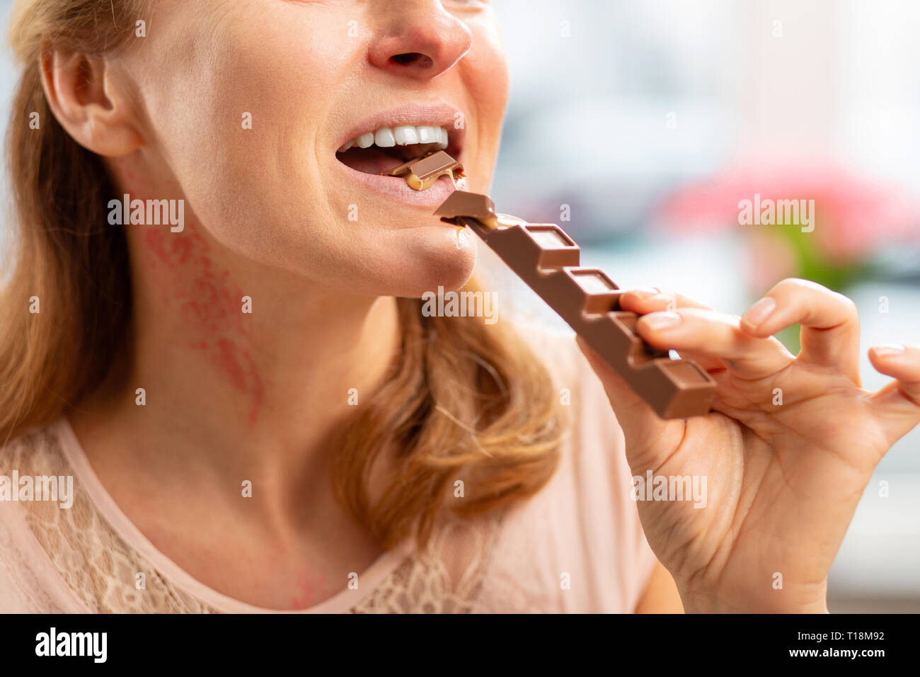 Woman with rash and reddening neck eating chocolate bar Stock Photo - Alamy