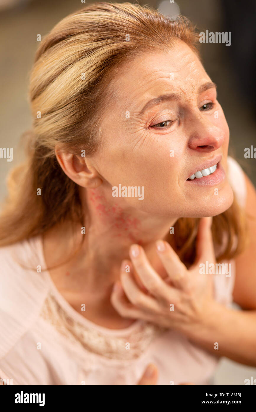Aged woman scratching her neck while having rash and fever Stock Photo ...