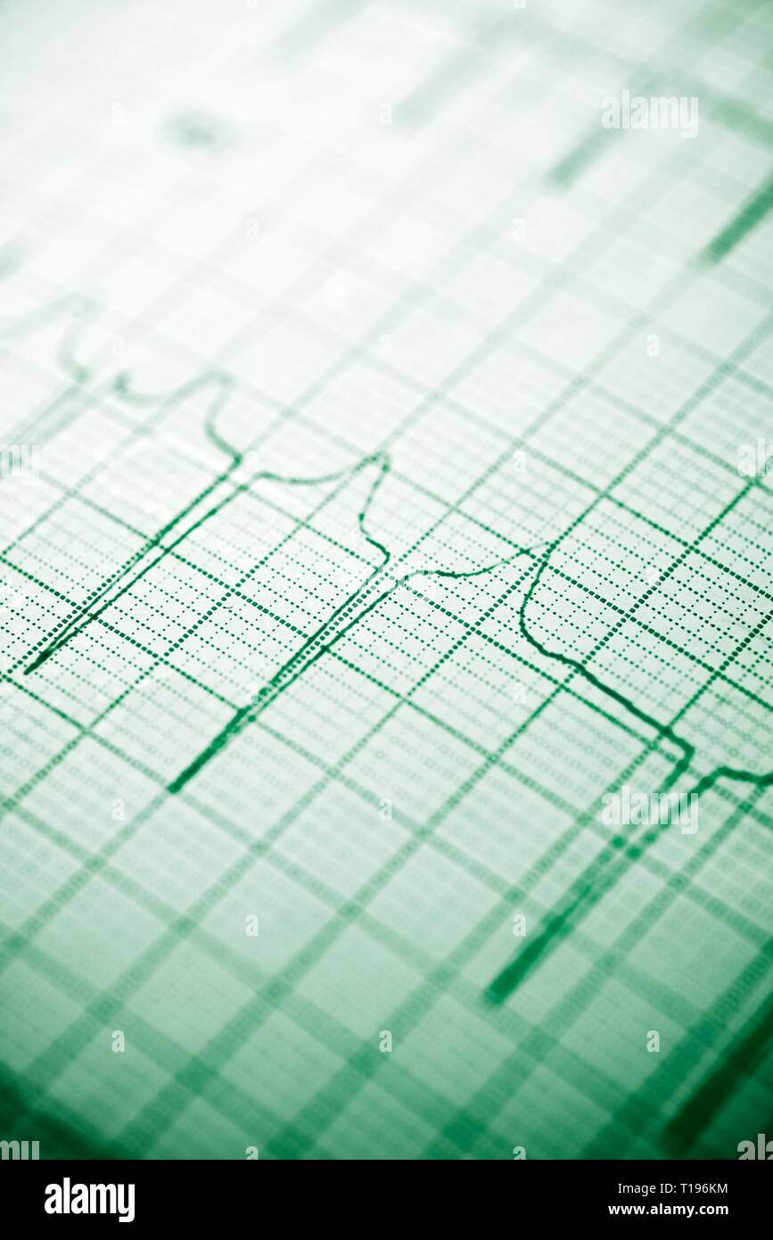 Close up of an electrocardiogram in paper form Stock Photo - Alamy