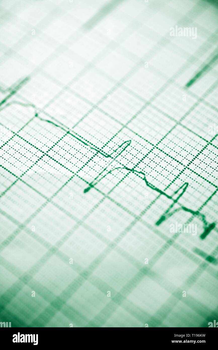 Close up of an electrocardiogram in paper form Stock Photo - Alamy