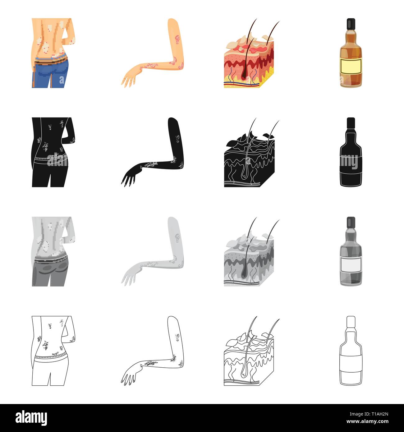 psoriasis,skin,dermatitis,epidermis,bottle,body,adipose,whiskey,eczema ...