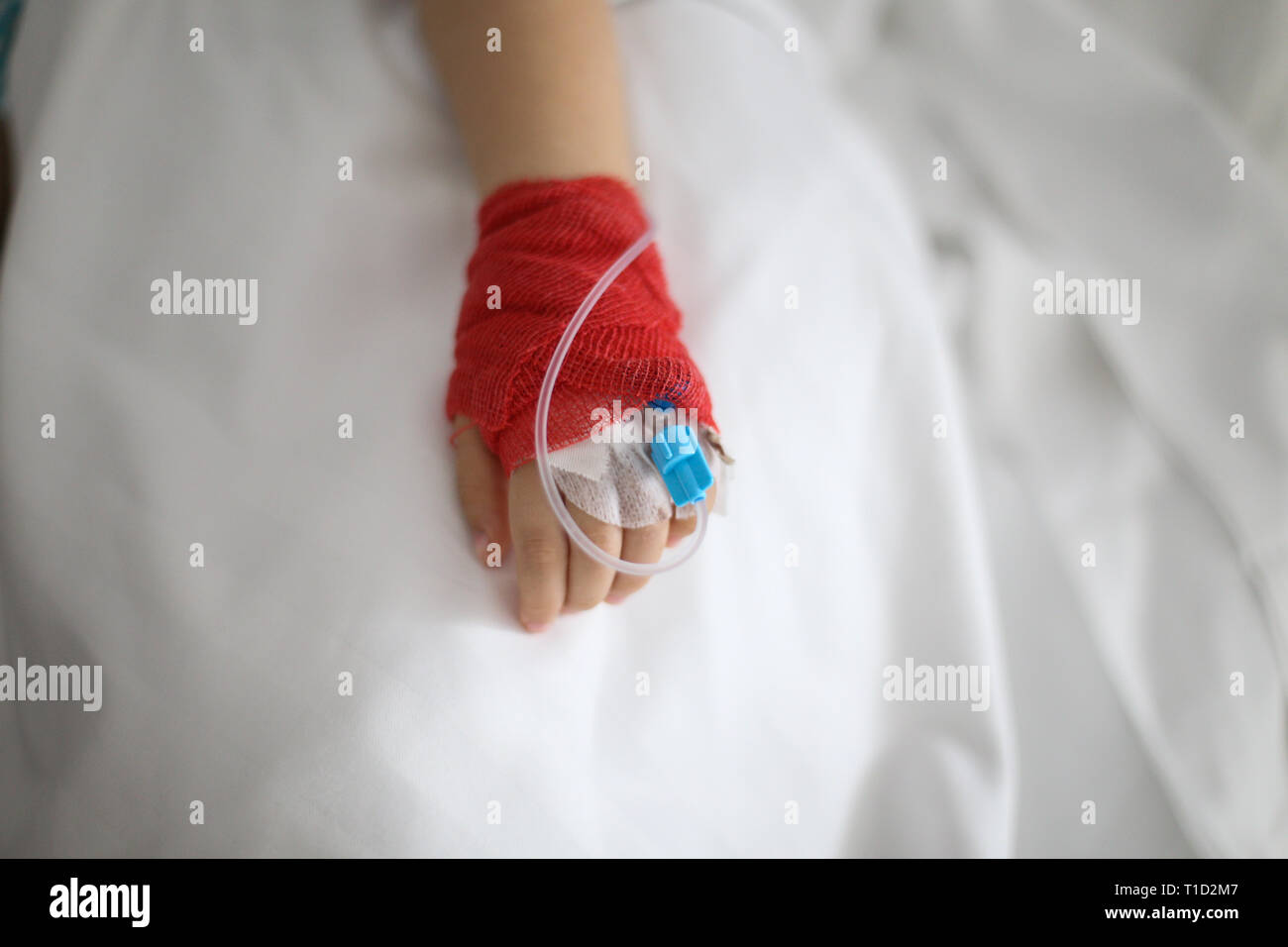 Cannula Stock Photos & Cannula Stock Images - Alamy