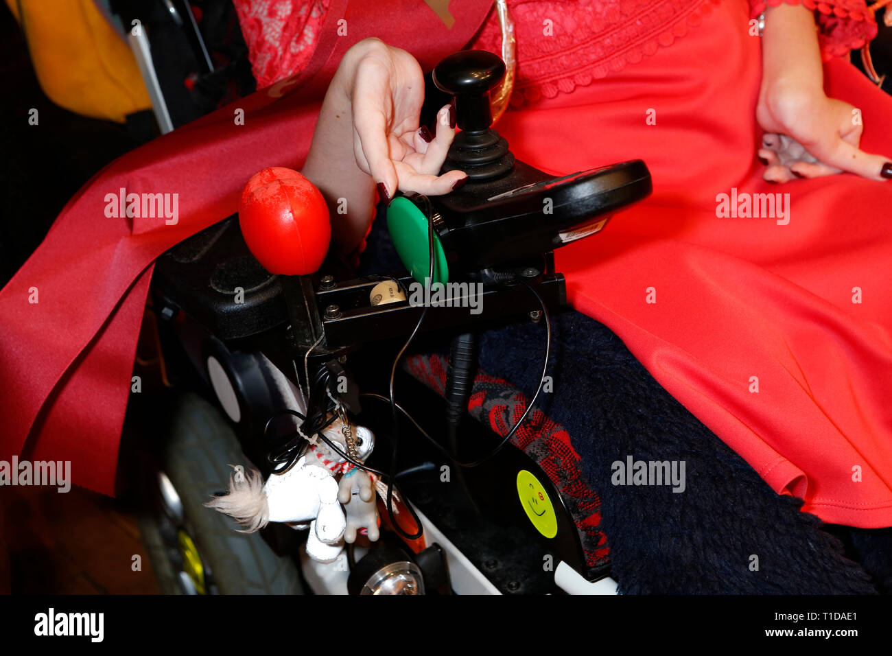 Close-up of the hand of a disabled woman Stock Photo - Alamy