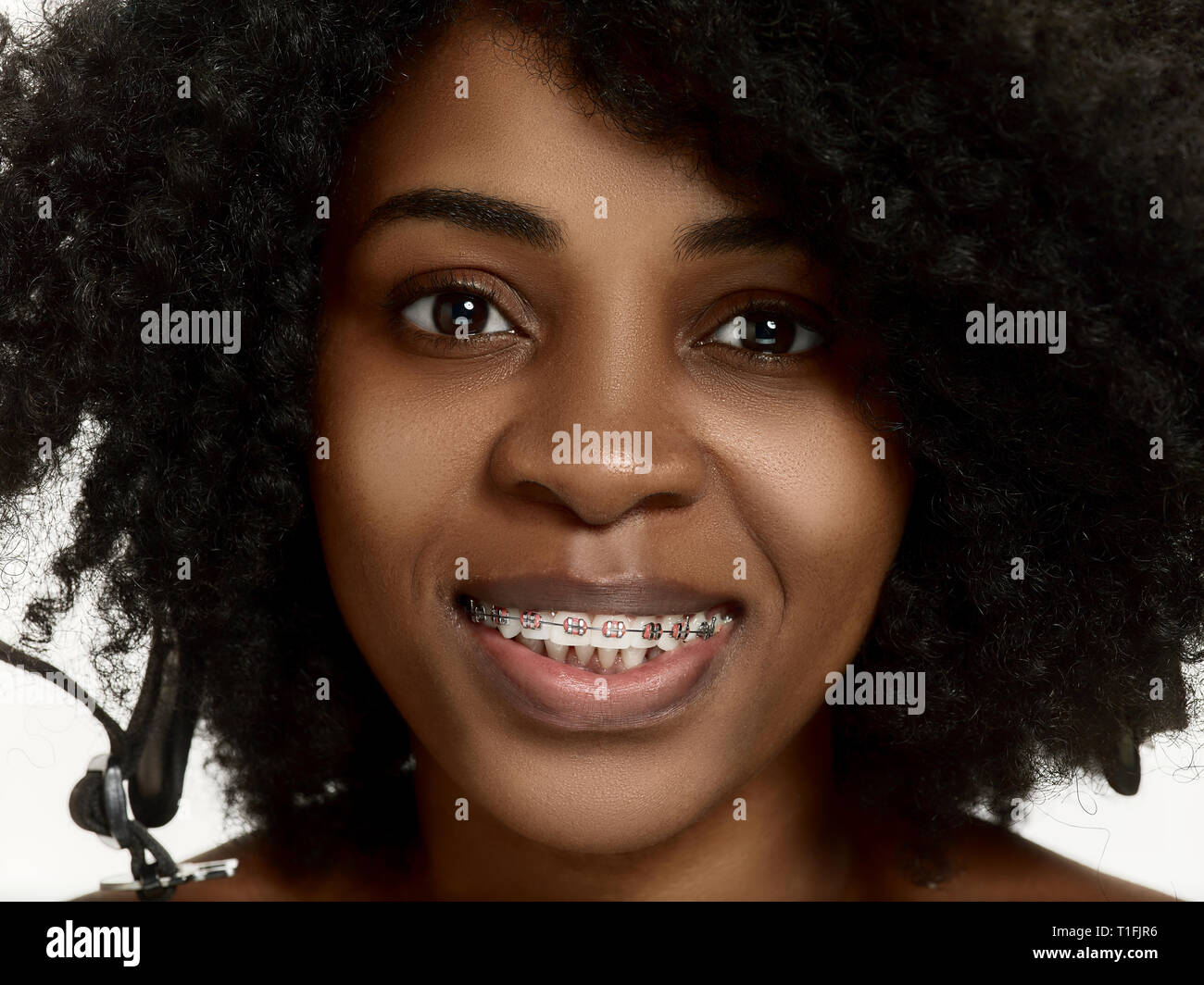 Braces orthodontics portrait smiling hi-res stock photography and images - Alamy