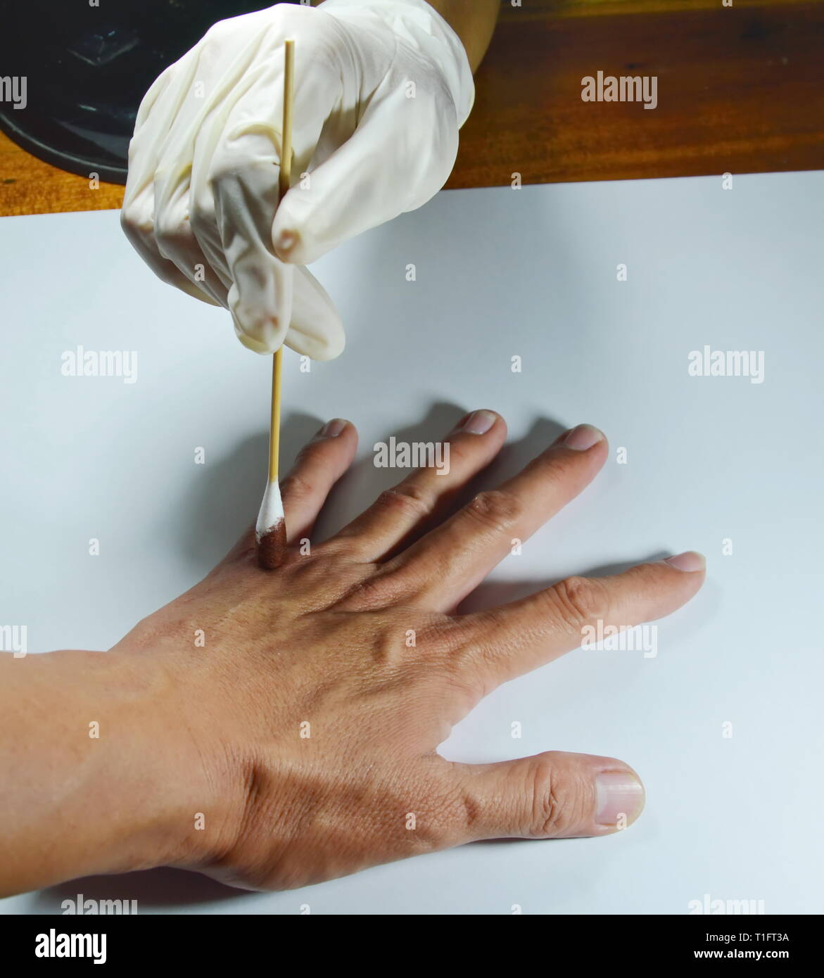 Laceration Wound High Resolution Stock Photography and Images - Alamy