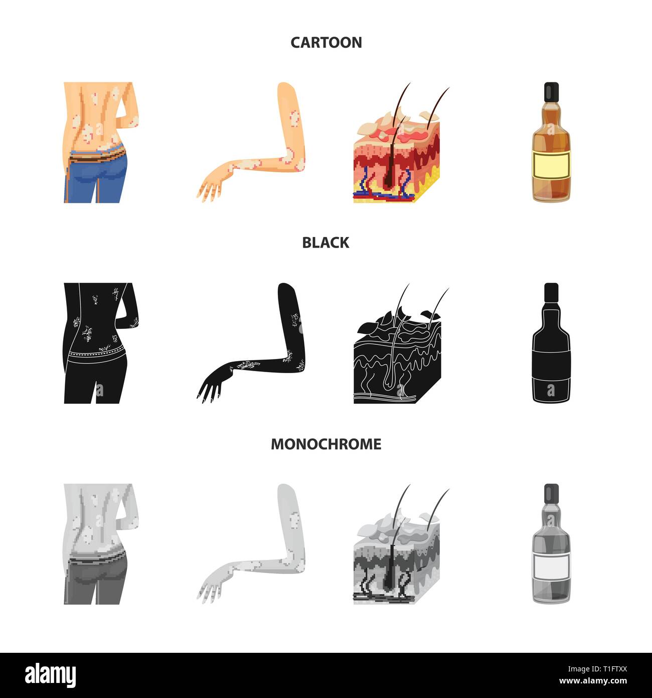 psoriasis,skin,dermatitis,epidermis,bottle,body,adipose,whiskey,eczema ...