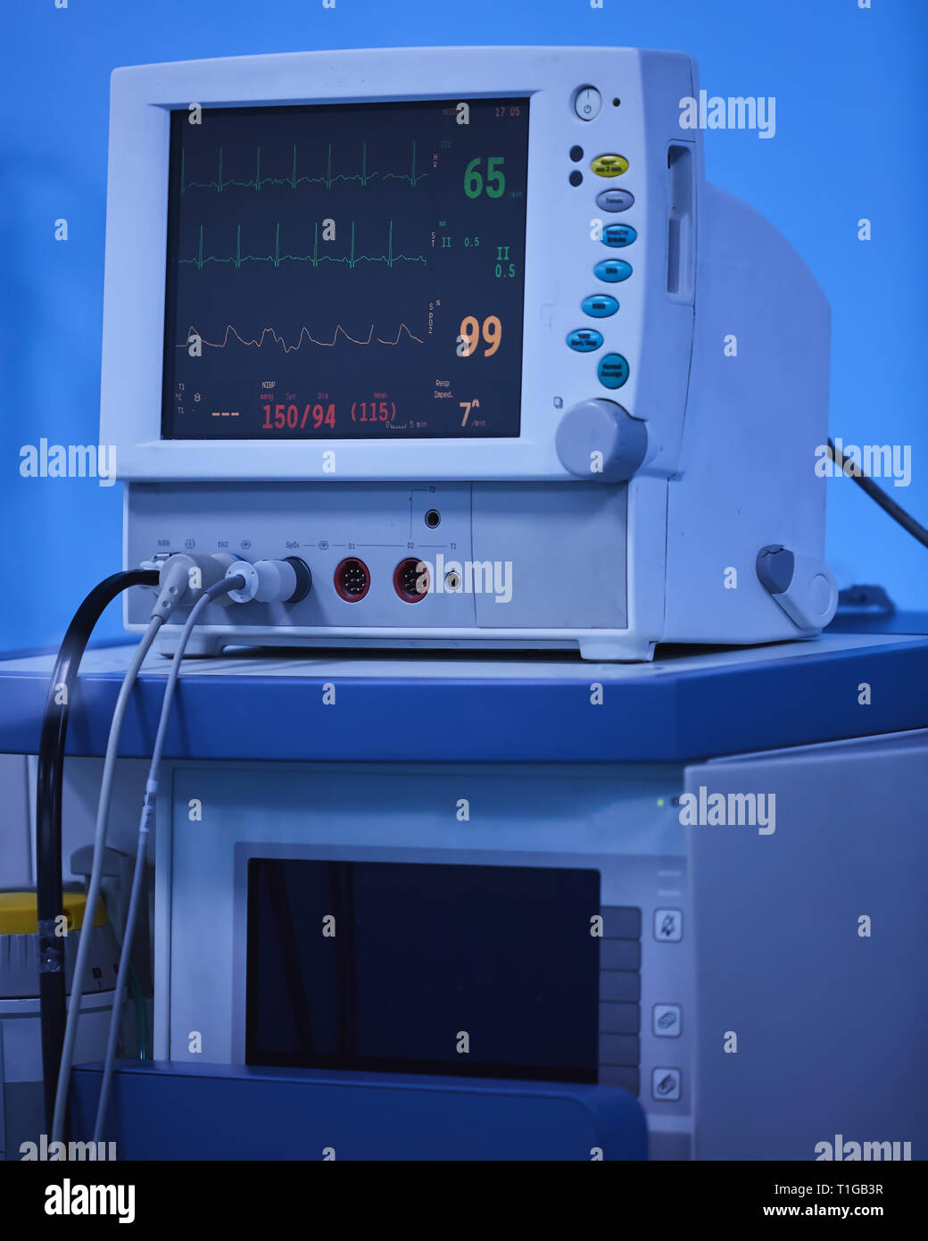 An anesthesia monitor shows real time vital signs for constant patient ...