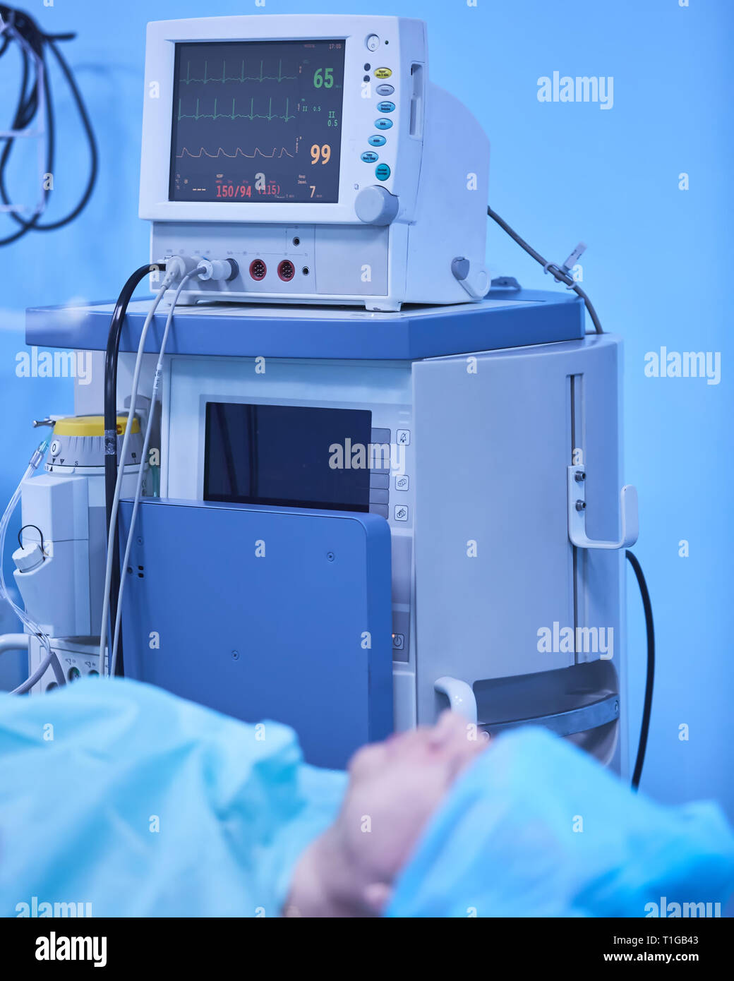 Functional vital functions monitor in an operating room with machines ...