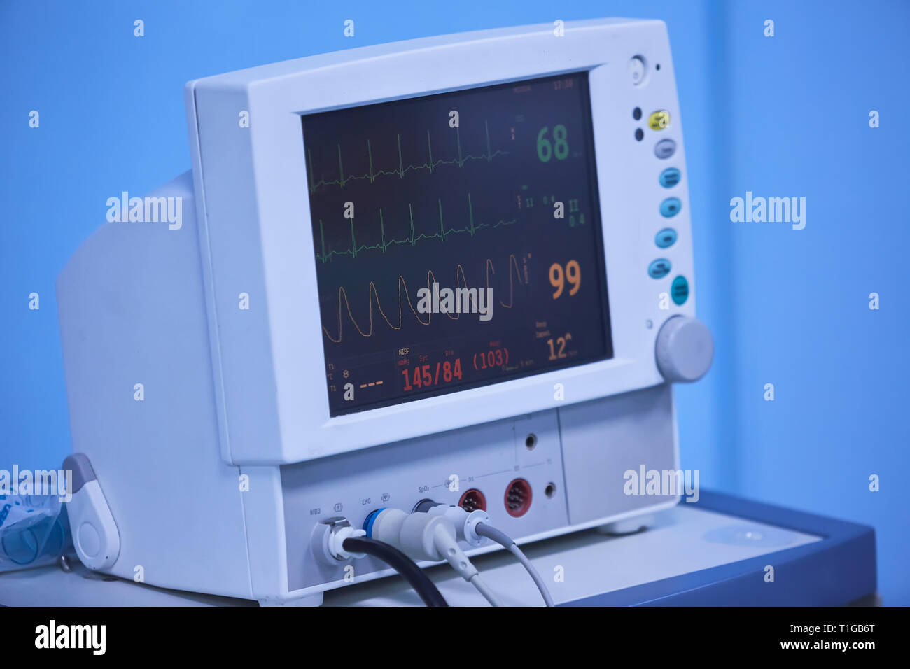 An anesthesia monitor shows real time vital signs for constant patient ...