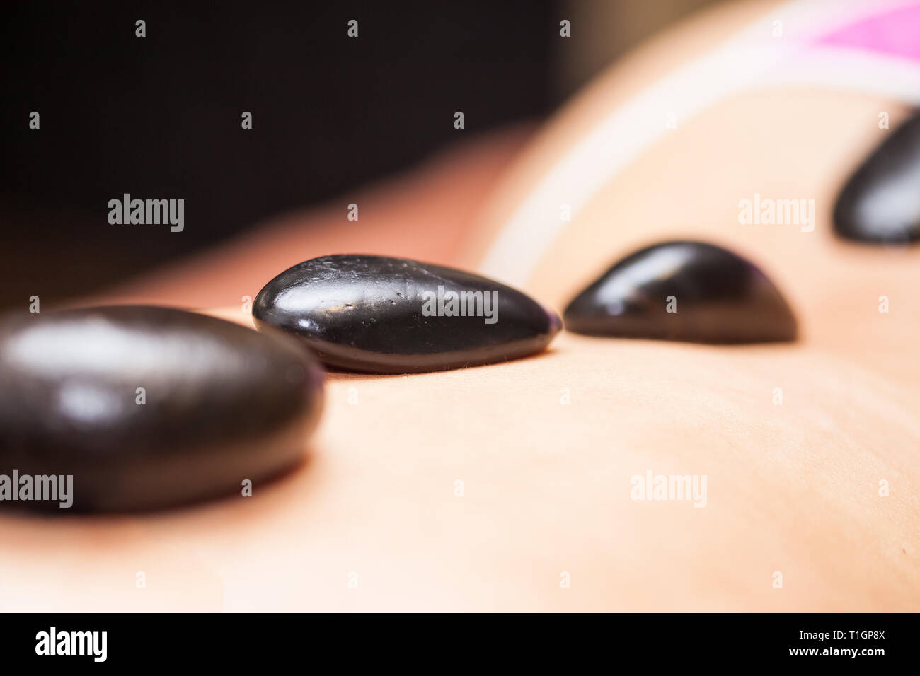 Doctor performing a hot volcanic stones therapy on a young female ...