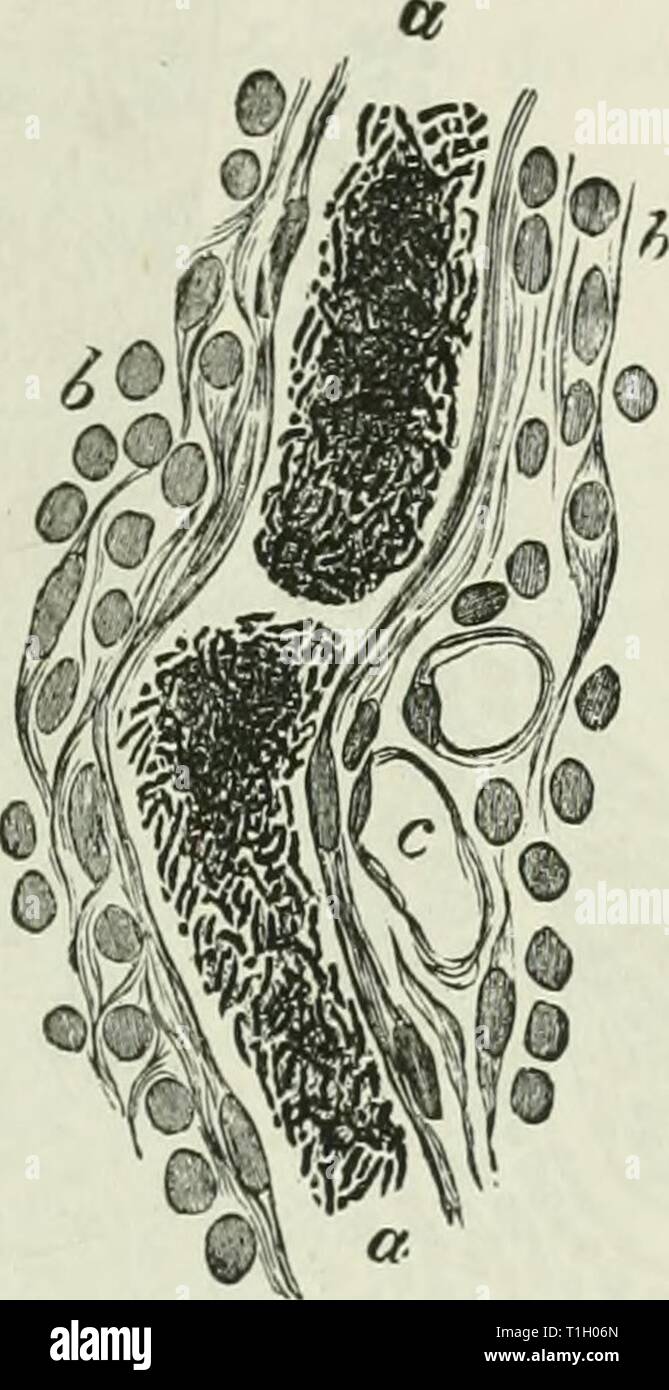 Peritoneal cavity hi-res stock photography and images - Alamy