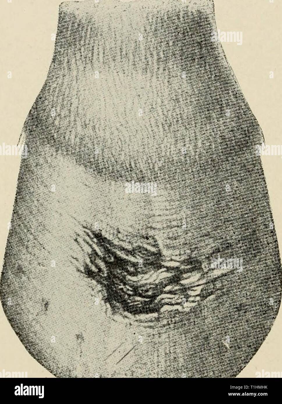 Diseases of the horse's foot Stock Photo - Alamy