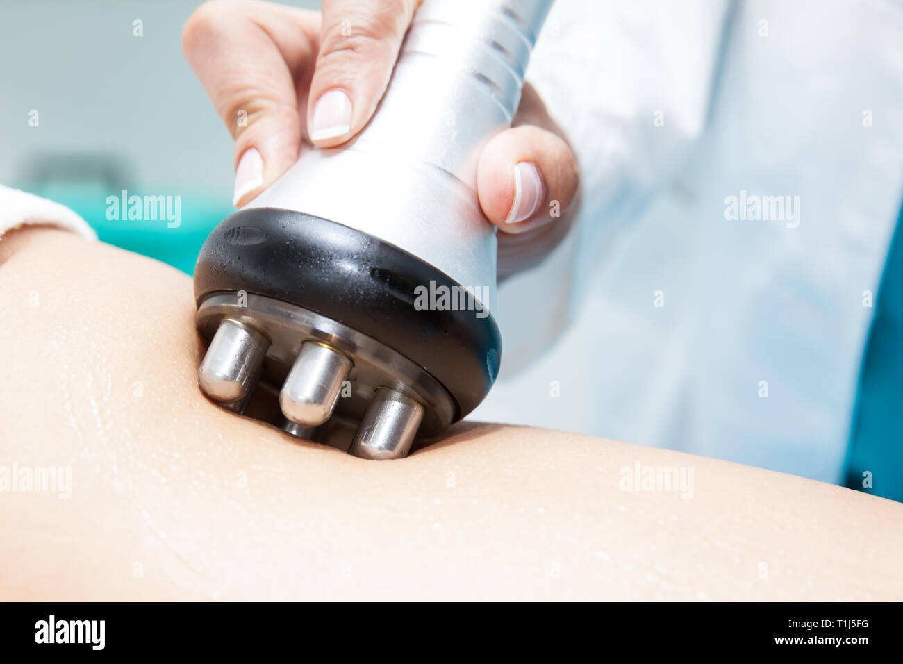 Doctor performing a radiofrequency treatment on a young female patient ...