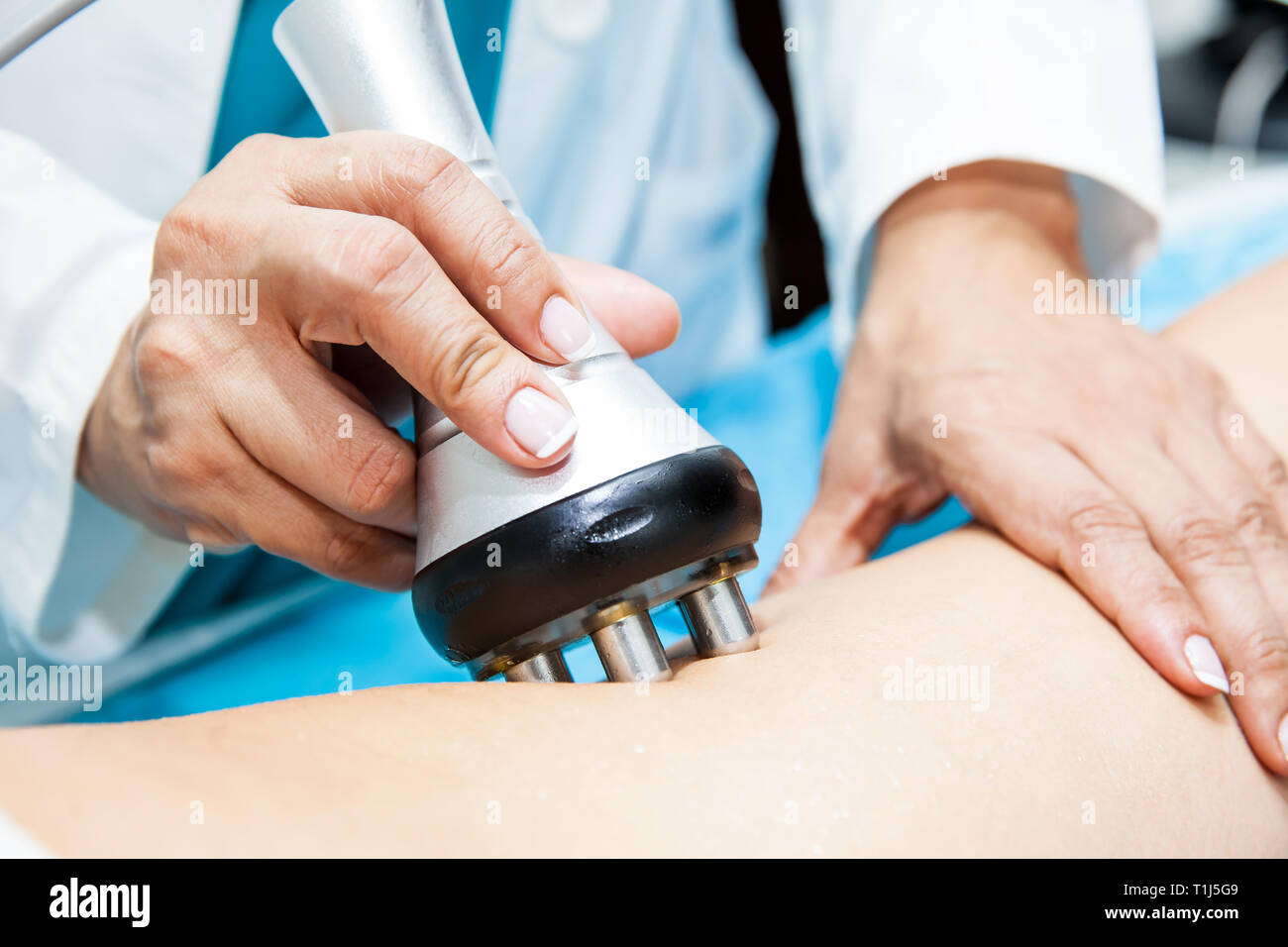 Doctor performing a radiofrequency treatment on a young female patient ...