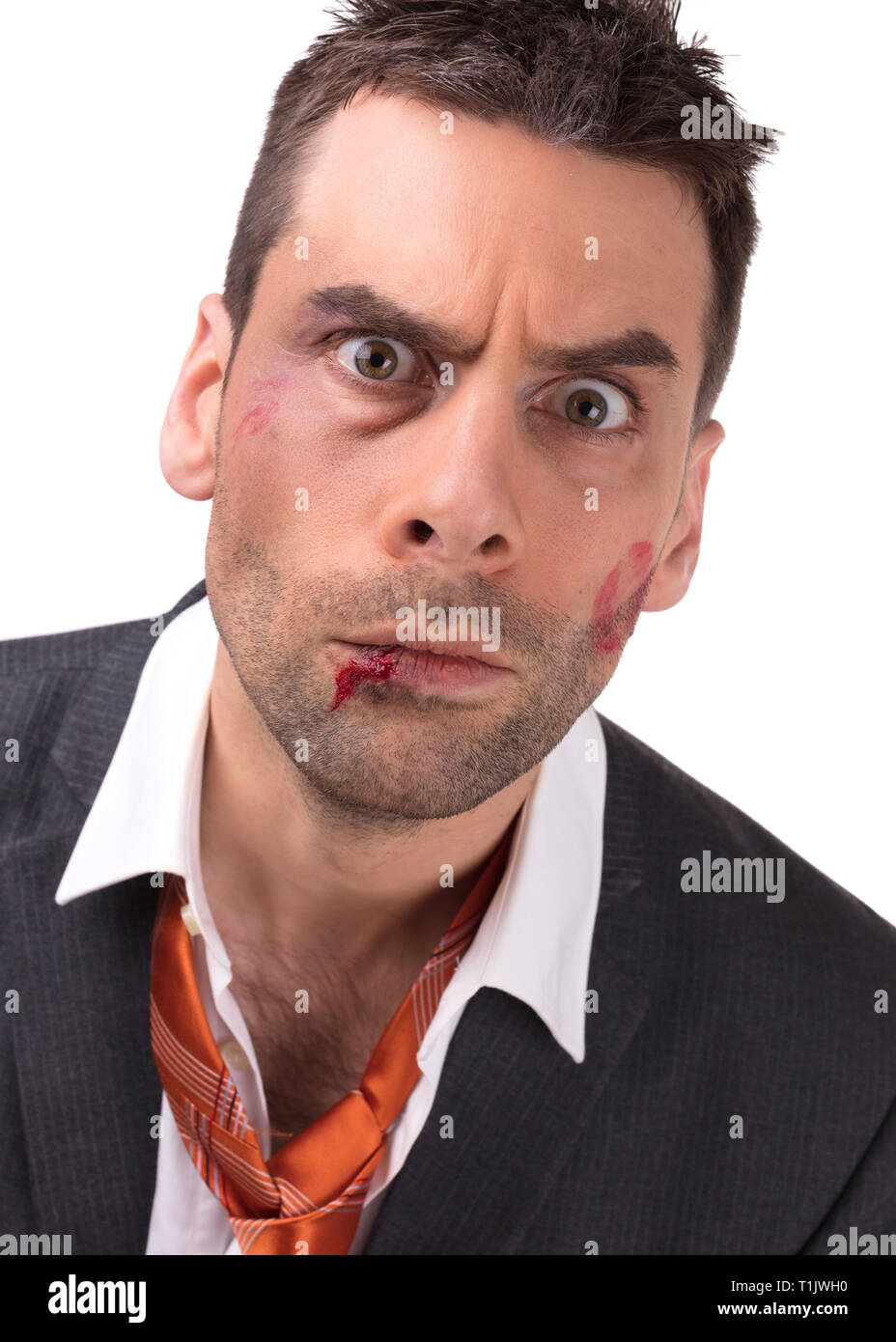 Close up of a businessman with bloody lip, beaten and bruised, isolated ...