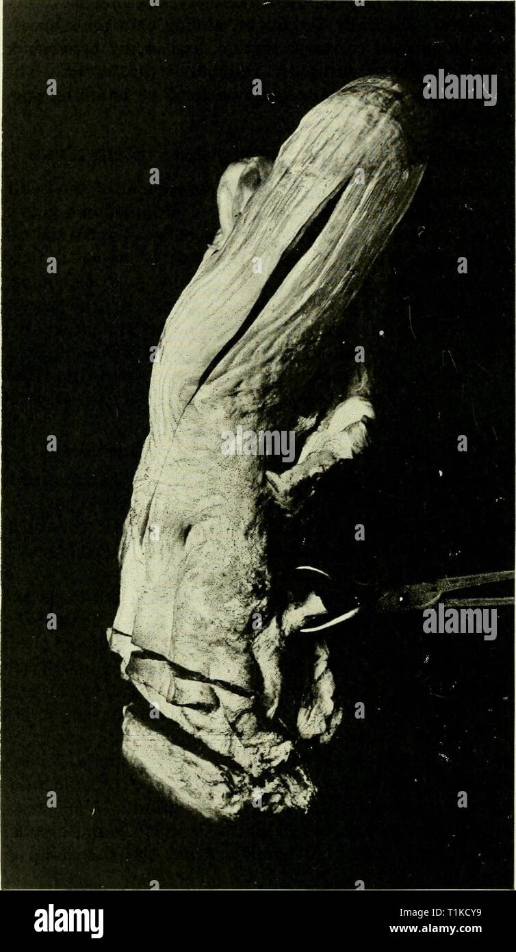 The diseases of the genital Stock Photo - Alamy