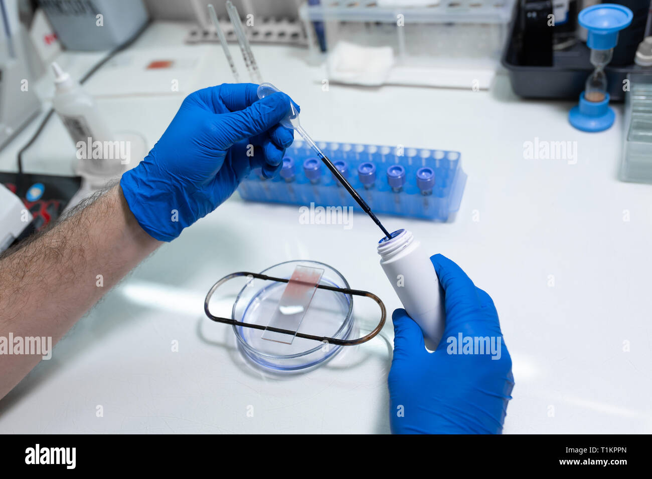 scientist prepare blood sample for research on microscope. Placing ...