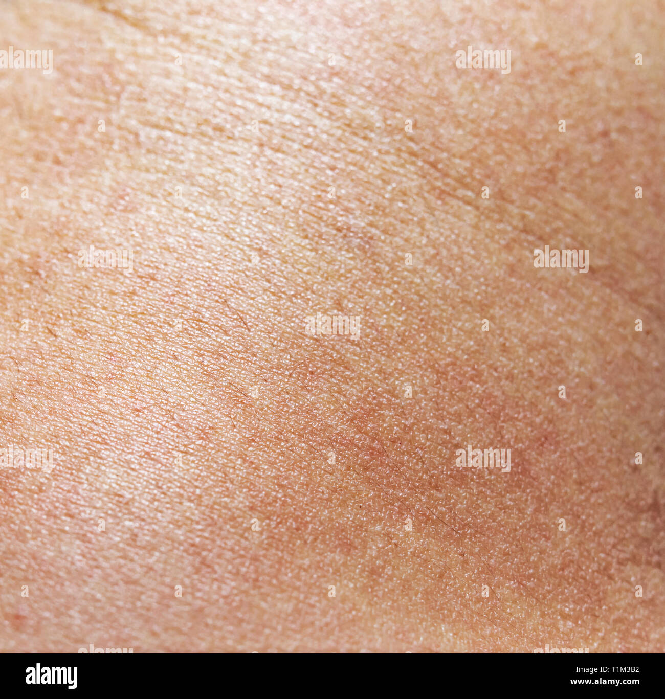 Skin creases hi-res stock photography and images - Alamy