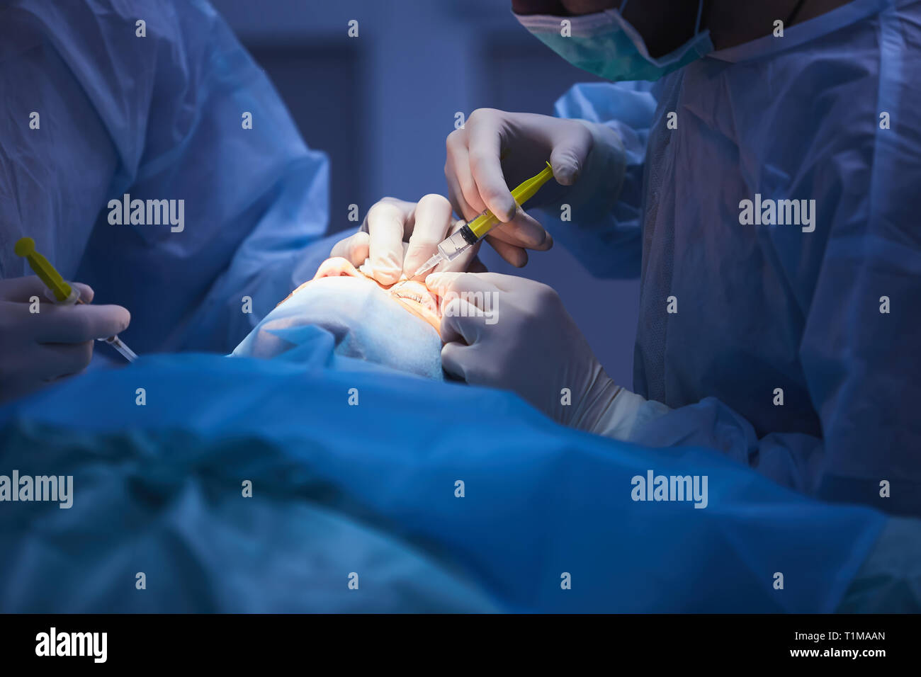Medical Team Performing Surgical Operation in Modern Operating Room ...