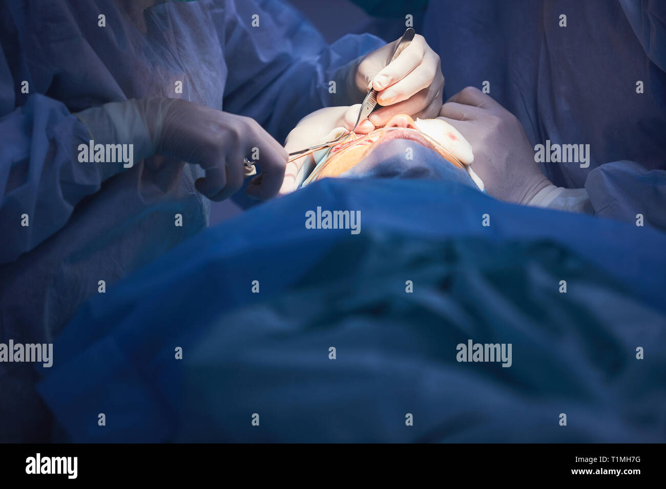 Asian doctor and an assistant in the operating room for surgical venous ...