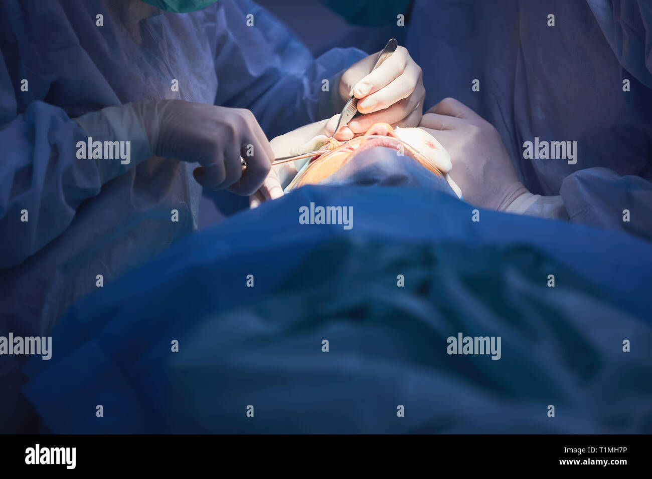 Asian doctor and an assistant in the operating room for surgical venous ...