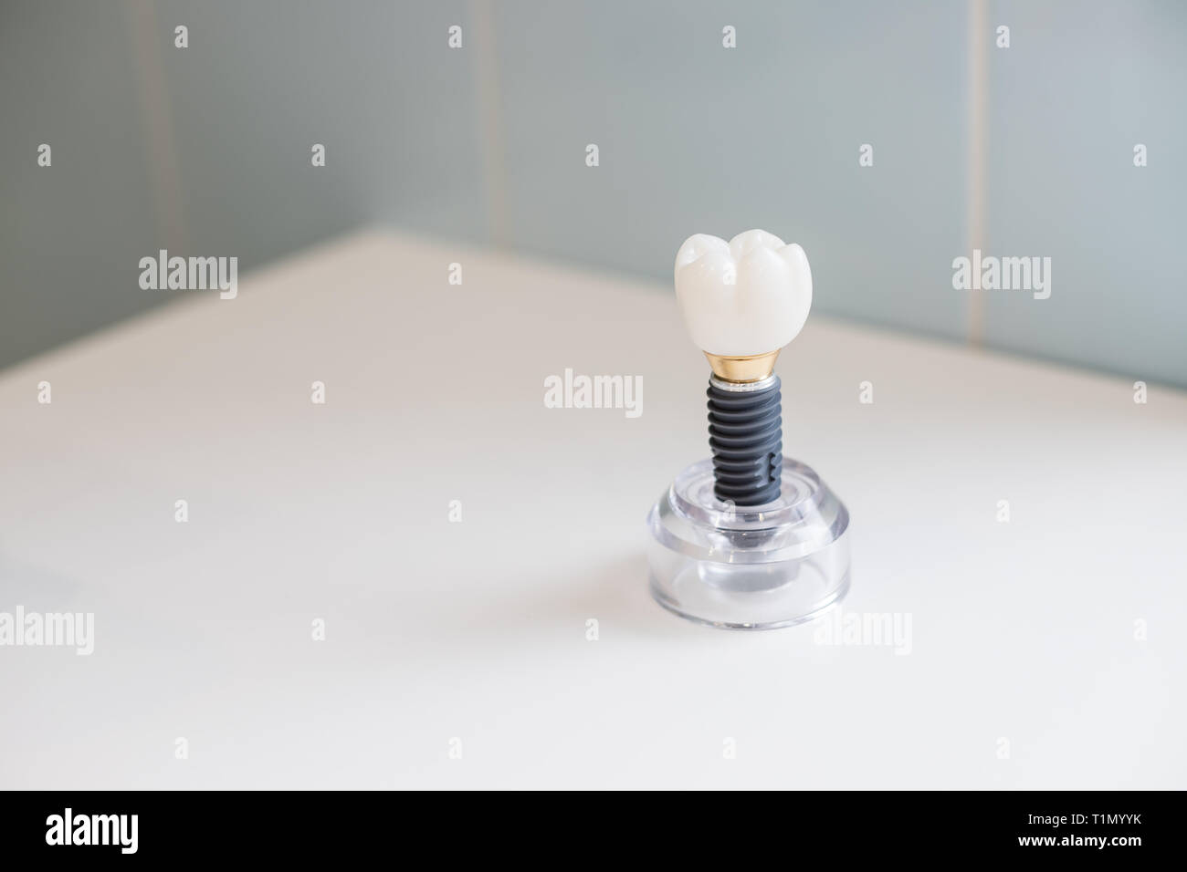 teeth model showing an implant crown bridge model .Dental Industry ...